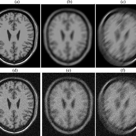 Visual Effects Of Different Models In Removing The Rician Noise σ 15