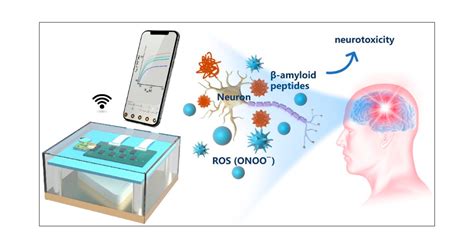Multi Engineered Graphene Extended Gate Field Effect Transistor For Peroxynitrite Sensing In