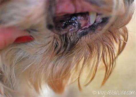 Lip Fold Dermatitis What Are Your Options My Gbgv Life
