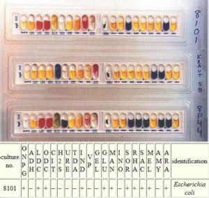 IDENTIFIKASI BAKTERI DENGAN METODE KIT API 20E Fakultas Perikanan Dan Kelautan