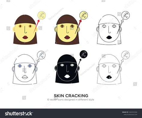 Various Type Skin Cracking Set Same Stock Vector Royalty Free 1663325326 Shutterstock