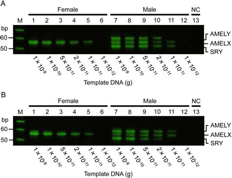 Sex Determination From Fragmented And Degenerated Dna By Amplified Product Length Polymorphism