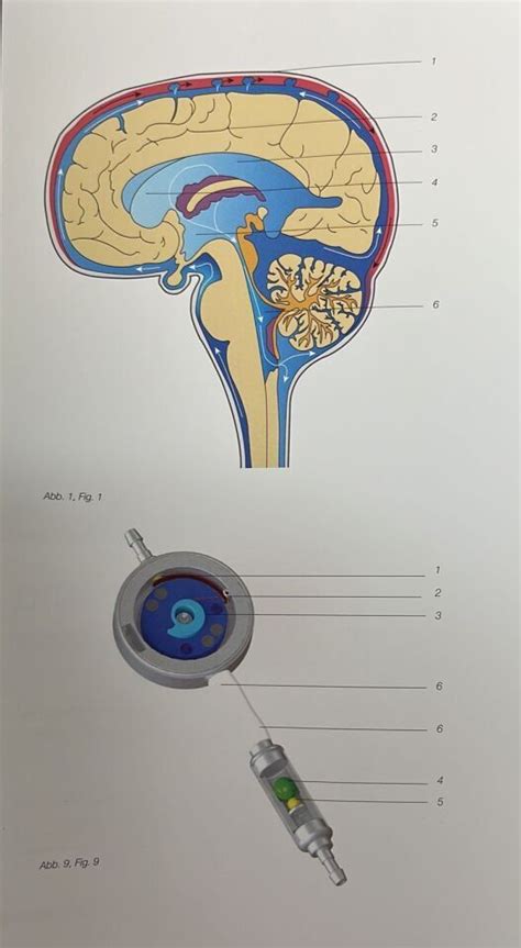 New B Braun Fx502t Progav 2 0 With Pedriatic Prechamber Disposables General For Sale Dotmed
