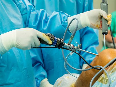 Joint Keyhole Surgery Arthroscopy Clinica Sandalf Benalmadena