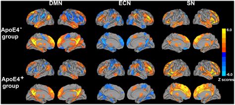 Functional Connectivity Pattern Of The Default Mode Network Dmn Download Scientific Diagram