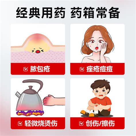 Erythromycin Soft Cream Genuine Anti Inflammatory External Antibacterial Infection For Private