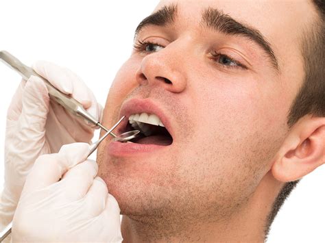 How Long Does Dry Socket Last And How Is It Treated