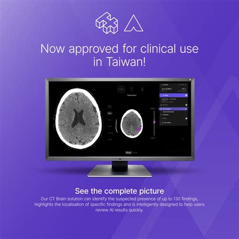 Harrison Ai On Linkedin Ai