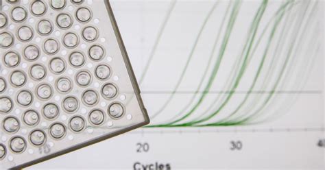 Single Step Sybr® Green Rt Qpcr Protocol Onelab