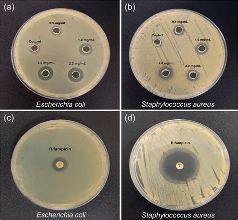 Assay Of Antibacterial Activity Of Zno Nanomaterials At Various Download Scientific Diagram