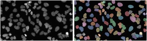 Cell Detection — Celldetection Release Documentation