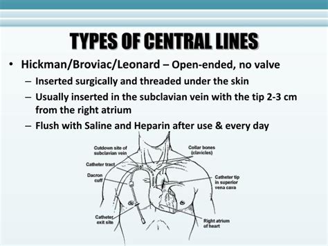 Ppt Central Lines Patient Safety Considerations Powerpoint