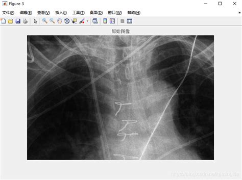 四、基于matlab的数字图像处理————频率域滤波（二）matlab Dftuv Csdn博客