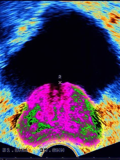 セックスと免疫力って関係ある？セックスしていない身体に生じる6つの問題点｜メンズヘルス公式