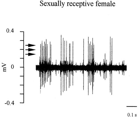 Quantification Of Spontaneous Multiunit Activity Sample Of Spontaneous Download Scientific