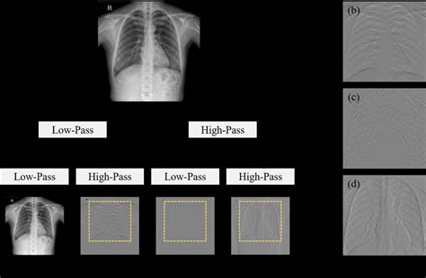 Haar 2d Wavelet Decomposition The Row Direction In Image Is Split Into