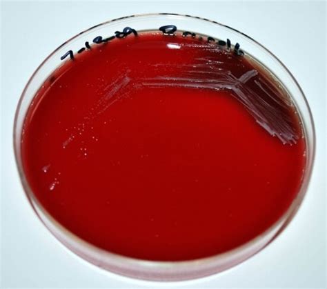 Free Picture Colonial Morphology Exhibited Colonies Brucella Abortus Bacteria