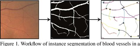 Figure 1 From Deep Semantic Instance Segmentation Of Tree Like