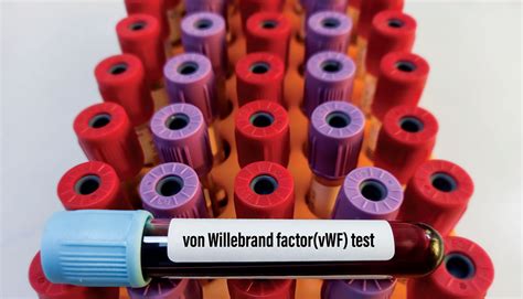 Code Von Willebrand Disease With Clarity Aapc Knowledge Center