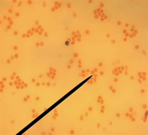 Chapter 3 Lab Exam Microscope Slides Flashcards Quizlet