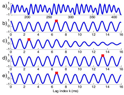 Waveform And Different Autocorrelation Functions Of A Synthetic Speech Download Scientific