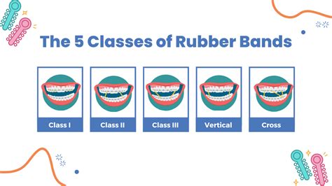 What Are The Rubber Bands For Braces Used For