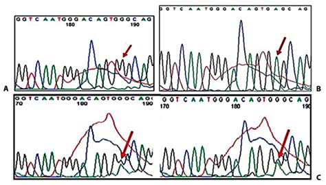 Sequence Chromatogram Of A A Healthy Individual Showing The Wild Type