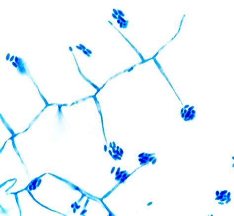 Mycology Quiz 2 Flashcards Quizlet
