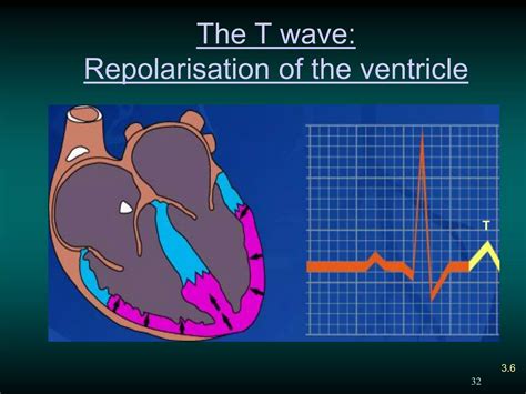 An Overview Of Paediatric Ecg Ppt