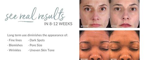 Pmd Beauty Personal Microderm Elite Pro At Home