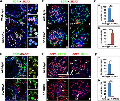 Androgen Receptor In Sertoli Cells Regulates Dna Double Strand Break