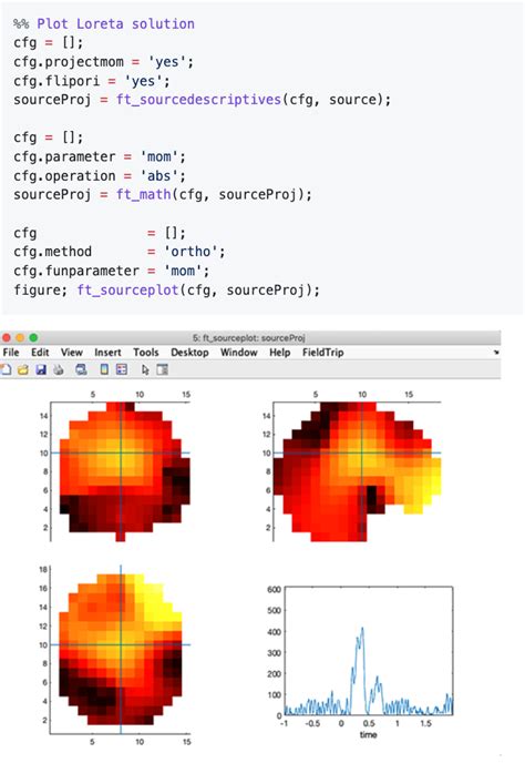 Ftsourceproj Issue · Issue 2274 · Fieldtripfieldtrip · Github