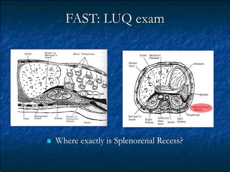 Ppt Introduction Powerpoint Presentation Free Download Id1216409