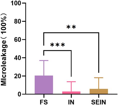 Microleakage Microgap And Shear Bond Strength Of An Infiltrant For Pit And Fissure Sealing