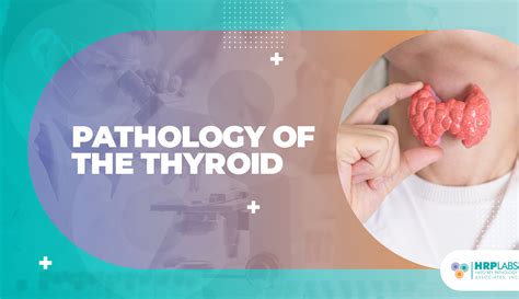 Pathology Of The Thyroid Hrp Labs