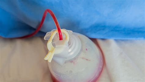 Swallowing Exercises How To Do Larynx Lifting Exercises Johns