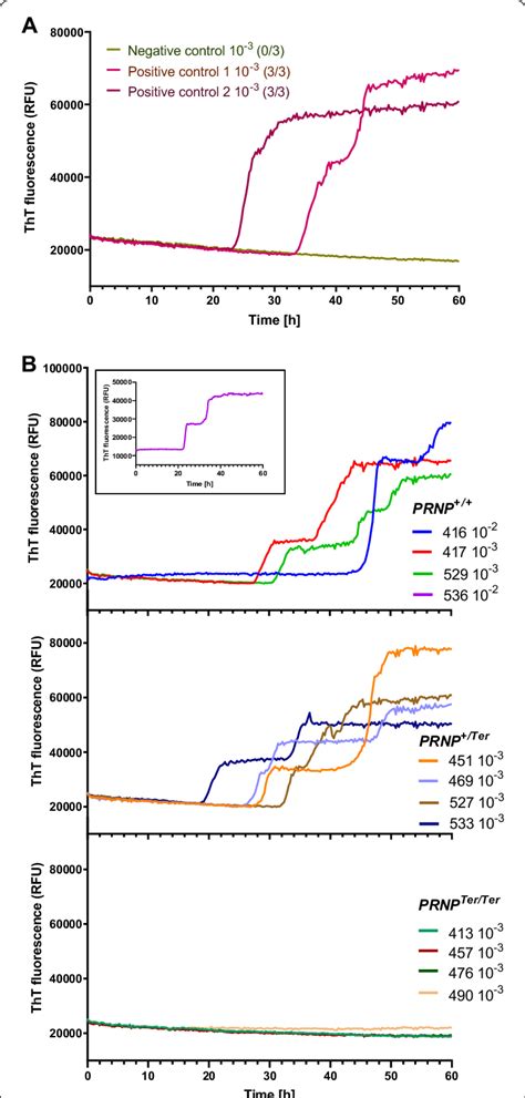 Detection Of Prion Seeding Activity By Rt Quic Rt Quic Was Performed