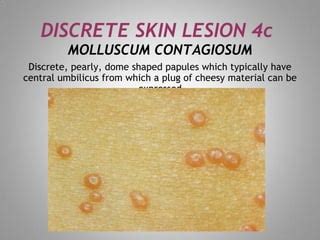 Skin Rash For Dermatology Field In Medical Field Pdf