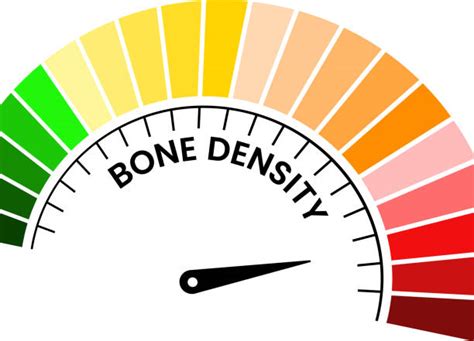 300 Bone Density Scan Stock Illustrations Royalty Free Vector