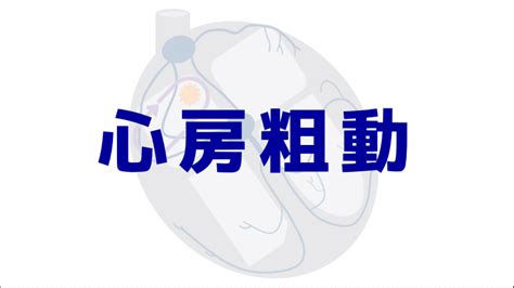 心電図イラスト心房粗動 プラセボ