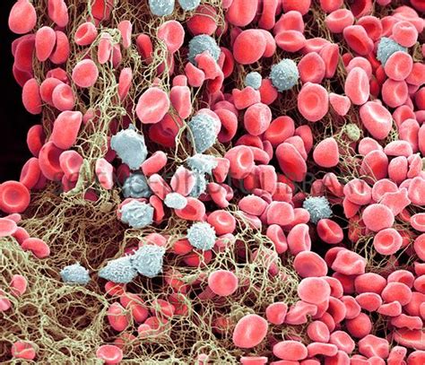 Bone Marrow Coloured Scanning Electron Micrograph Sem Of Bone Marrow