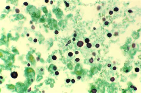 Cryptococcus