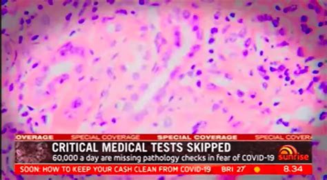 An Increase In Pathology Media Mentions Despite A Drop In Testing