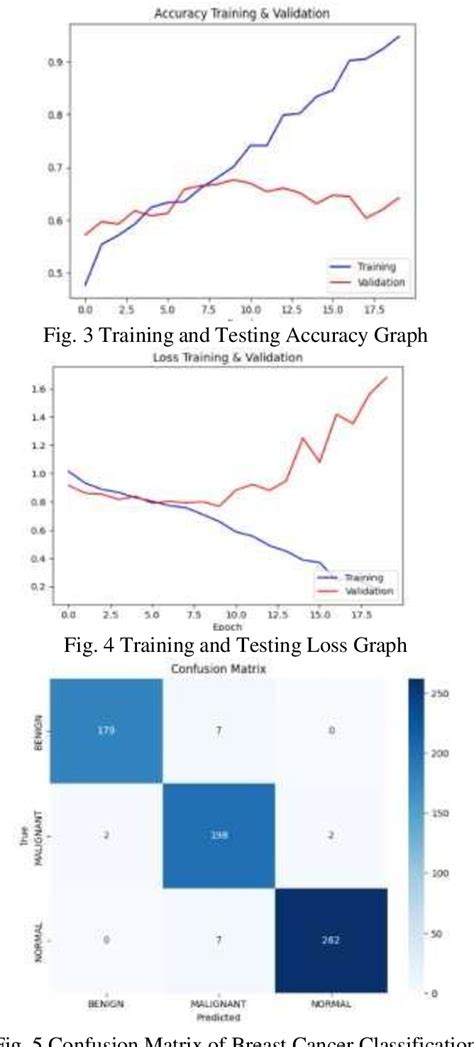 Figure 4 From Breast Cancer Classification Through Ct Scan Using Convolutional Neural Network