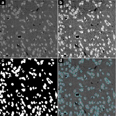 Cell Segmentation Result Of The Ns1 Image Of The Nsmost Dataset A Download Scientific