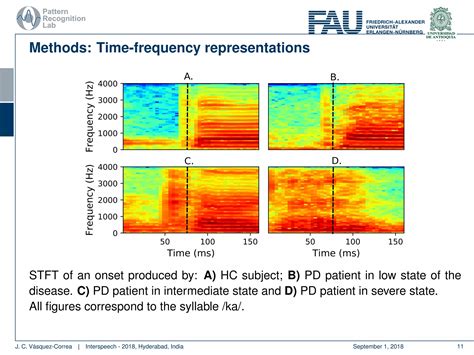 A Multitask Learning Approach To Assess The Dysarthria Severity In