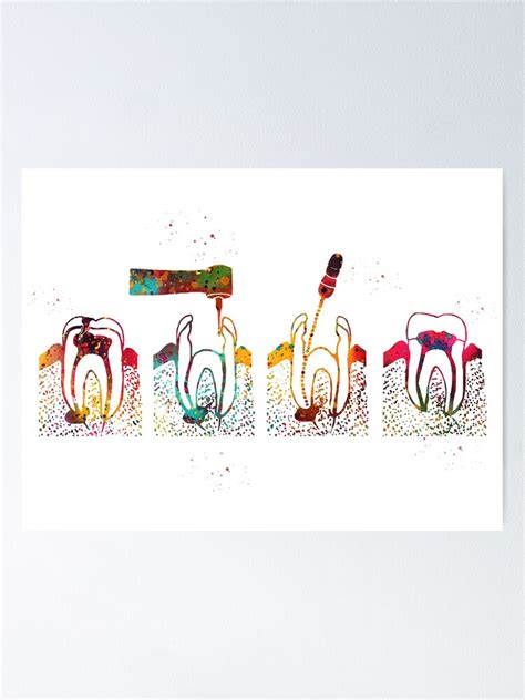 The Root Canal Therapy Poster By Erzebetth Redbubble