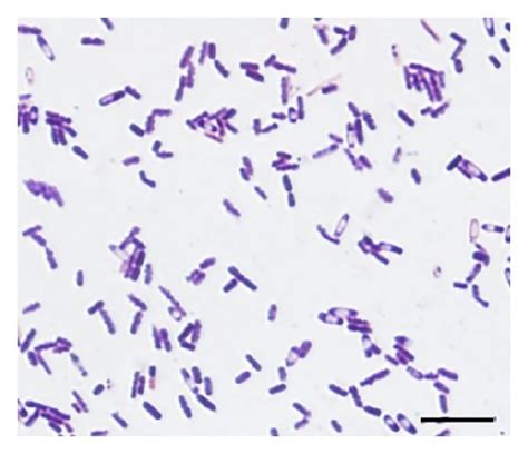 Gram Positive Rods In Clusters Gram Stain Of Gram Positive Cocci And