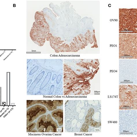 Expression Profile Of The Antigen Recognized By NEO In Patient Download Scientific Diagram