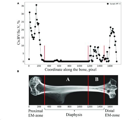 Illustration Explaining The Procedure Of The Bone Segmentation With